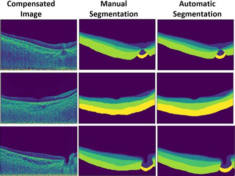 Are Macula Or Optic Nerve Head Structures Better At Diagnosing Glaucoma An Answer Using Ai And