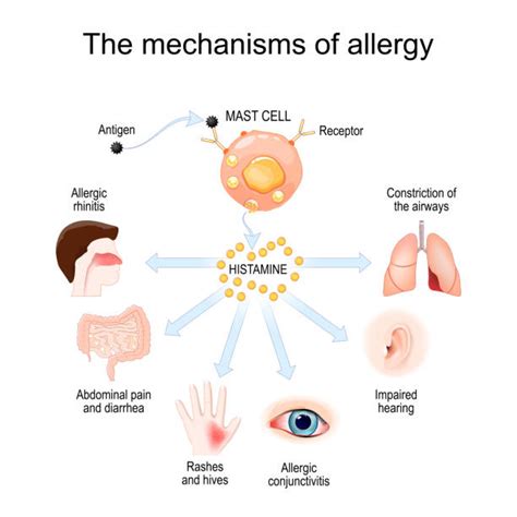 Anaphylactic Reaction Illustrations Royalty Free Vector Graphics