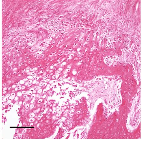 A High Magnification Photomicrograph Shows Skeletal Muscle 4 Weeks