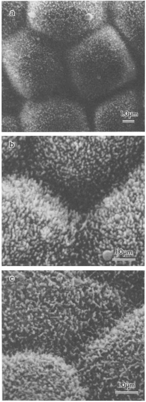 Figure 1 From Epithelial Cytoskeletal Framework And Nuclear Matrix