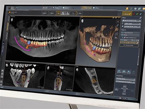 Descubre qué significa tc en odontología y para que sirve