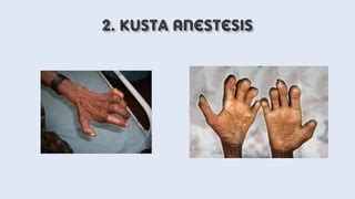 Aku Mau Jadilah Engkau Tahir Pdf Khotbah Kristen PPT