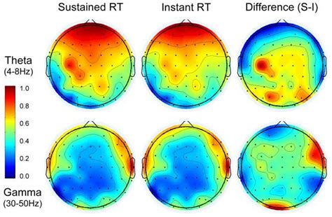 Theta And Gamma Oscillatory Activation During Query Task Classified Download Scientific