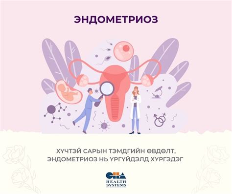 Эндометриоз гэж юу вэ ЧА эрүүл мэндийн төв