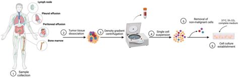 In Vitro Diffuse Large B Cell Lymphoma Cell Line Models As Tools To