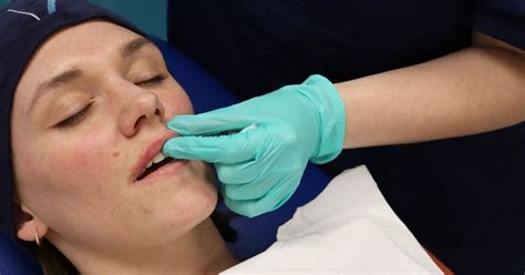 Lip Filler Injection Techniques For Restoring Volume Harley Academy