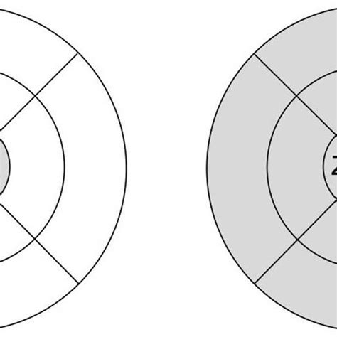 Classification Of Dme Dme Was Categorized According To Extent And