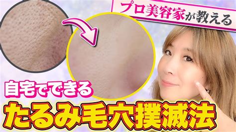 【プロ美容家が教える老化防止】頬の たるみ毛穴 を自力で治す方法！原因から対策まで紹介！！ Youtube