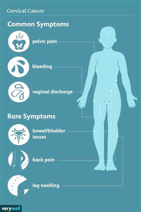 Cervical Cancer Discharge