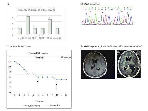 Patients´clinicalpatients´clinical Features And Idh1 Mutations A Age Download Scientific
