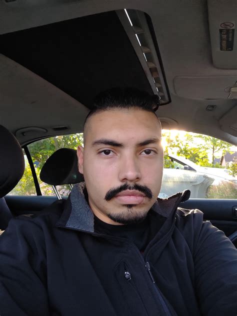 Scars Are From An Animal Bite What Should I Work On Rtruerateme