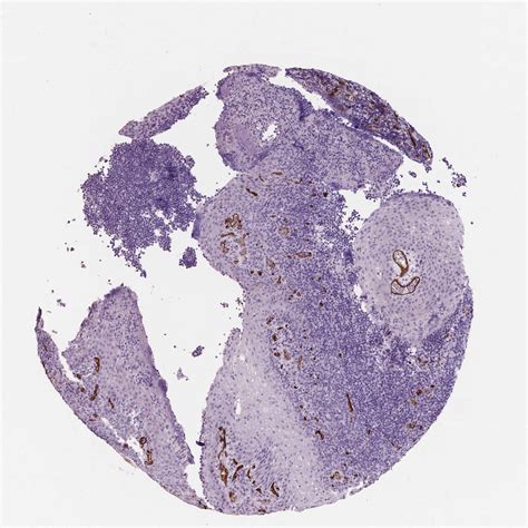 Tissue Expression Of Cd34 Staining In Tonsil The Human Protein Atlas