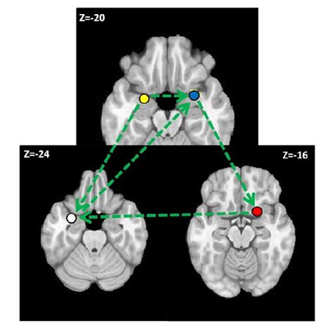 The Effective Connectivity Model For Odor Processing Download Scientific Diagram