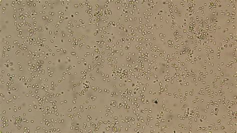 Leuconostoc In Health And Industry Archives Medical Notes