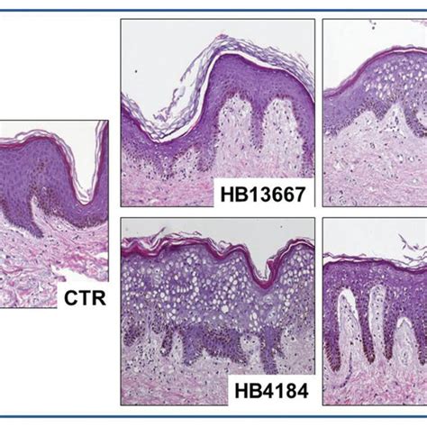 Biofilm Formation Bacterial Biofilms Stained With Crystal Violet