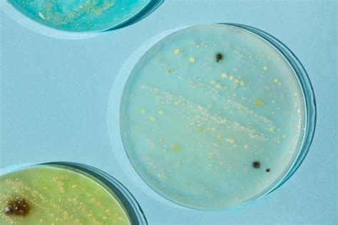La Resistencia Bacteriana A Los Antibióticos Tendría Un Lado Positivo