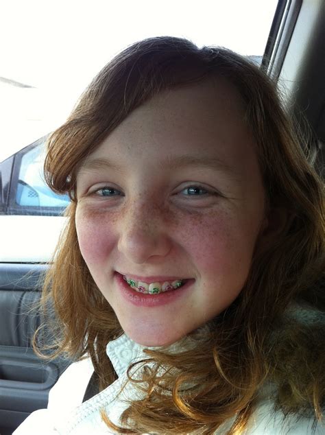 Party Of Five New Braces