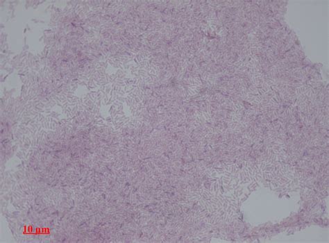 Gram Negative Bacilli Rods Microbiology Learning The Whyology Of