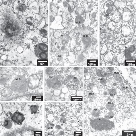 Autophagosomes Electron Microscopy