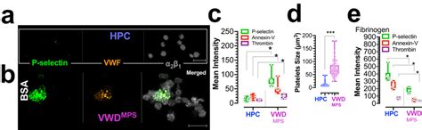 Platelet Clumping In 2b Vwd Of The Original Montreal Platelet Syndrome