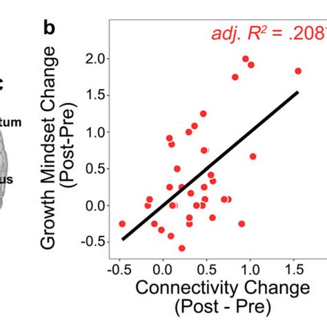 Plasticity Of Dorsal Acc Subcortical Functional Connectivity Associated Download Scientific