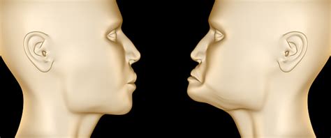 하악턱 치아를 잃은 후 뼈 경기 침체 의학적으로 정확한 치과 3d 일러스트레이션 감소에 대한 스톡 사진 및 기타 이미지 감소 개선 건강관리와 의술 Istock