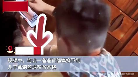 儿子拿钢丝球给爸爸挠后背，享受变成轻微挠伤，老父亲差点被送走