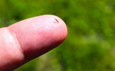 Duri Pokok Duri Tujuh Masuk Dalam Jari Buang Guna Cara Ini