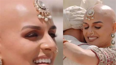 बिन बालों की ब्राइड निहार सचदेव का बोल्ड एंड ब्यूटीफुल लुक ताने मारने