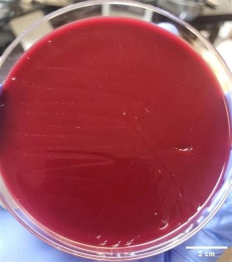 Mycoplasma Hominis Is A Facultative Anaerobic Bacterium Commonly