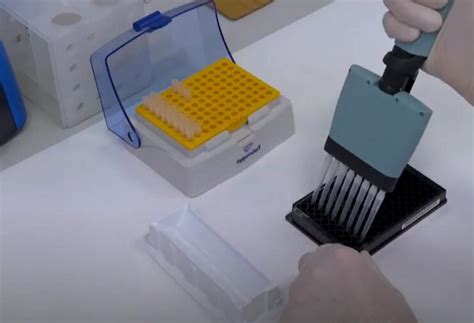 Hiv Elisa Test And Hiv Eclia Test The Power Of Accuracy