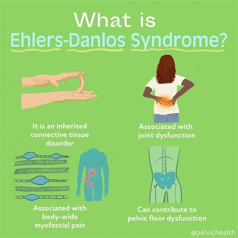 Has Ehlers Danlos Syndrome Ehlers Danlos Traitement Cini