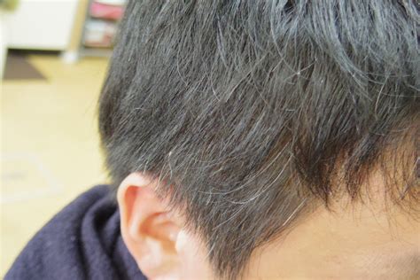 白髪染めをしたいけど頭皮に不安を感じるあなたへ白髪染めならヘナで染めましょ～メンズ編〜｜ヘナのお悩み相談室