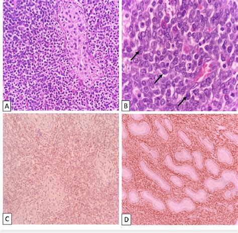 Histopathological Examination Of The Testis Panel A Testicular