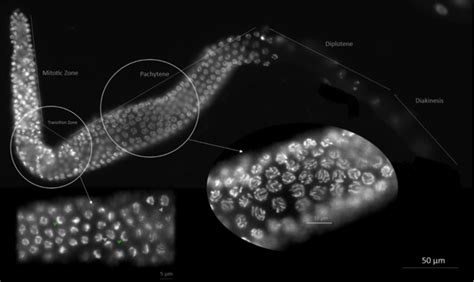 Spatial And Temporal Development Of The Germline In Hermaphrodite C Download Scientific