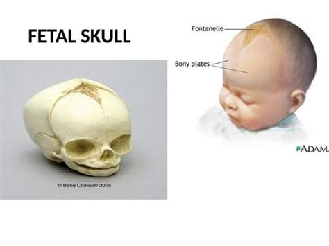 Fetal Head Diameters Ppt Fetal Head Diameters Ppt