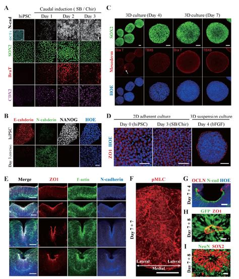 Production Of Human Spinal Cord Organoids Recapitulating Neural Tube