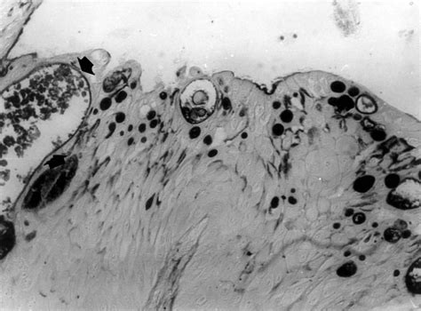 The Spherules Showing Great Variability In Size Up To Ten Fold The