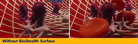 Surpass Elite Flow Diverter Stryker