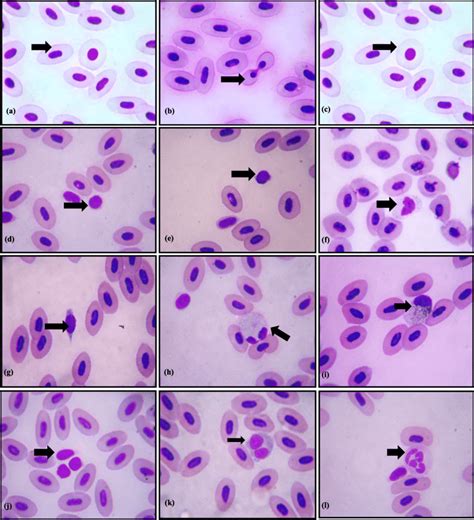Microstructure Of Peripheral Blood Cells Of S Niger A L
