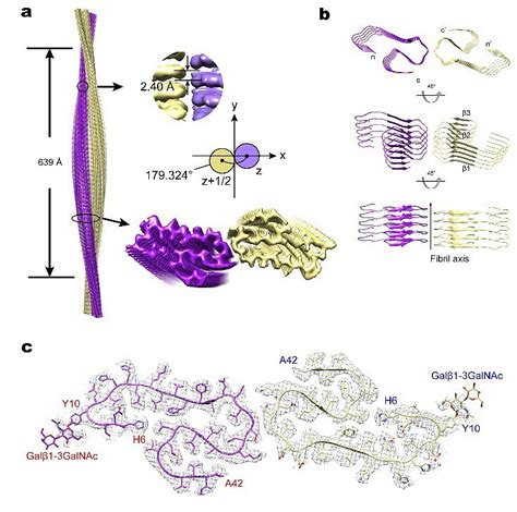 北大董甦伟中科院刘聪团队jacs：揭示糖基化修饰调控β淀粉样多肽聚集新机制 X Mol资讯
