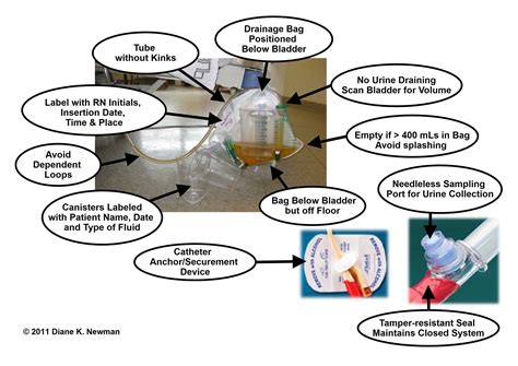 Urinary Catheter Drainage Bag Care Best Drain Photos Primagemorg