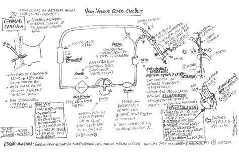 Pediatric Surgery Zone Sketchnotes Vv Ecmo