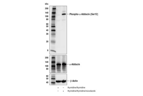 Phospho α Adducin Ser12 E5x8y Rabbit Mab Cell Signaling Technology