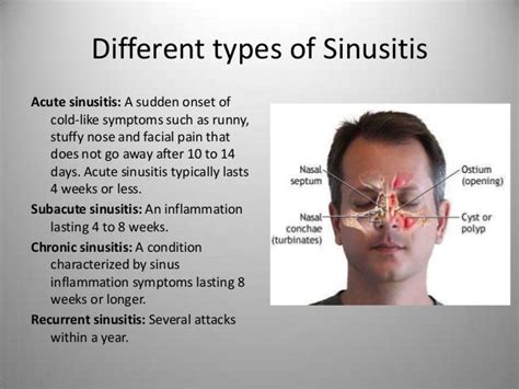 Sinus Drainage Definition