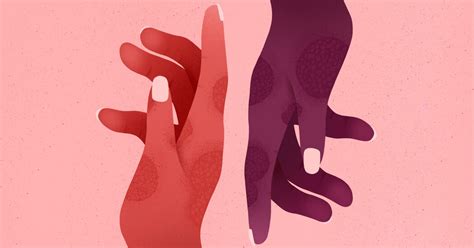 What Exactly Is Eczema Causes Of Atopic Dermatitis And Treatment The