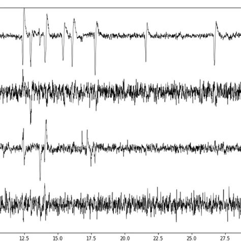 Sources Of Data Captured Applying Ica To A Raw Eeg Signal Download
