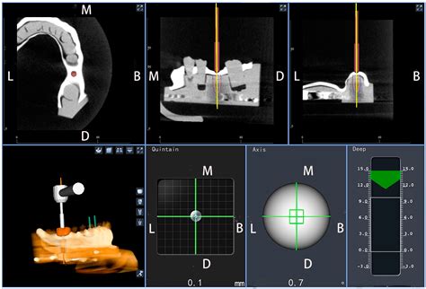 Proposal And Validation Of A New Nonradiological Method For Postoperative Three Dimensional