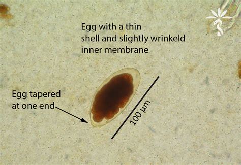 Creepy Dreadful Wonderful Parasites Answer To Case 496