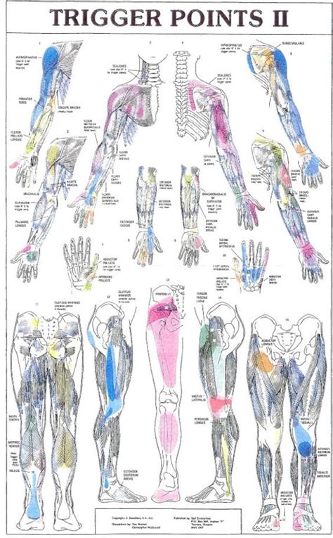 Lupus Trigger Points Diagram